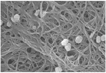 Deleterious Particles in Lubricating Grease